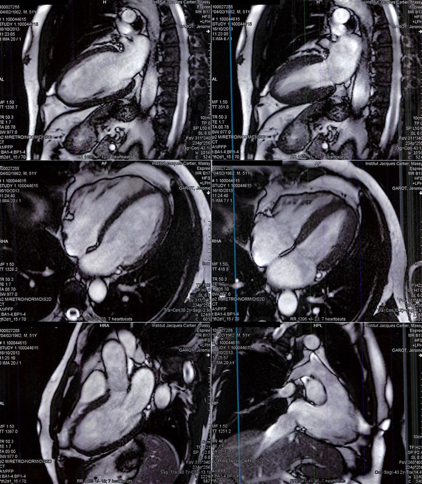 Imagerie par résonnance magnétique (IRM) - Centre Cœur et Santé